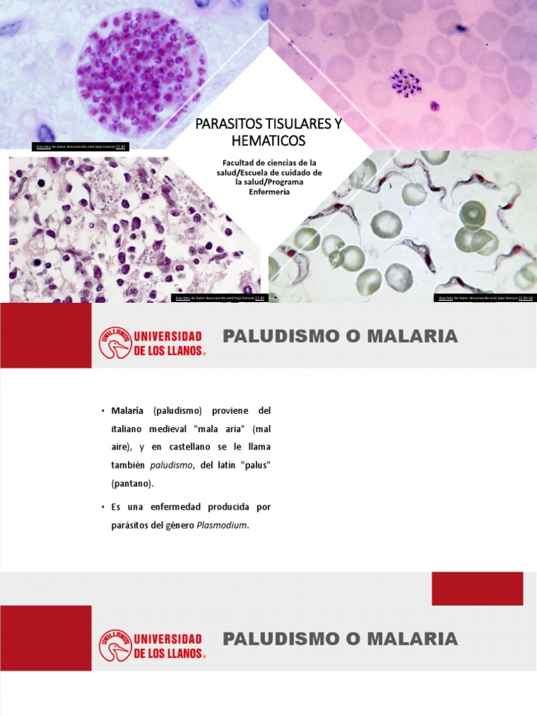 Semana 15 Microbiologia - Parasitos Tisulares | PDF | Malaria | Plasmodium