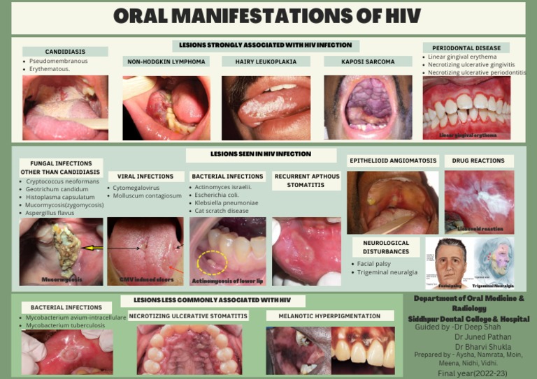 Oral Manifestation of Hiv | PDF | Medical Specialties | Health Sciences