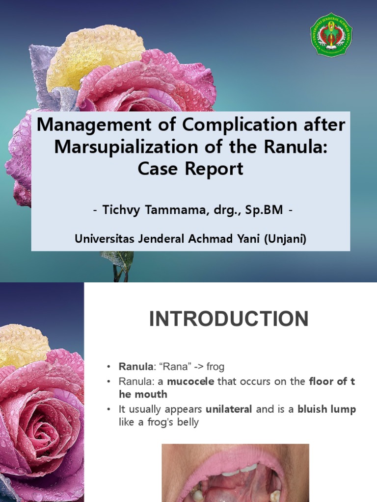 Managing Complications of Ranula Marsupialization | PDF | Medical ...