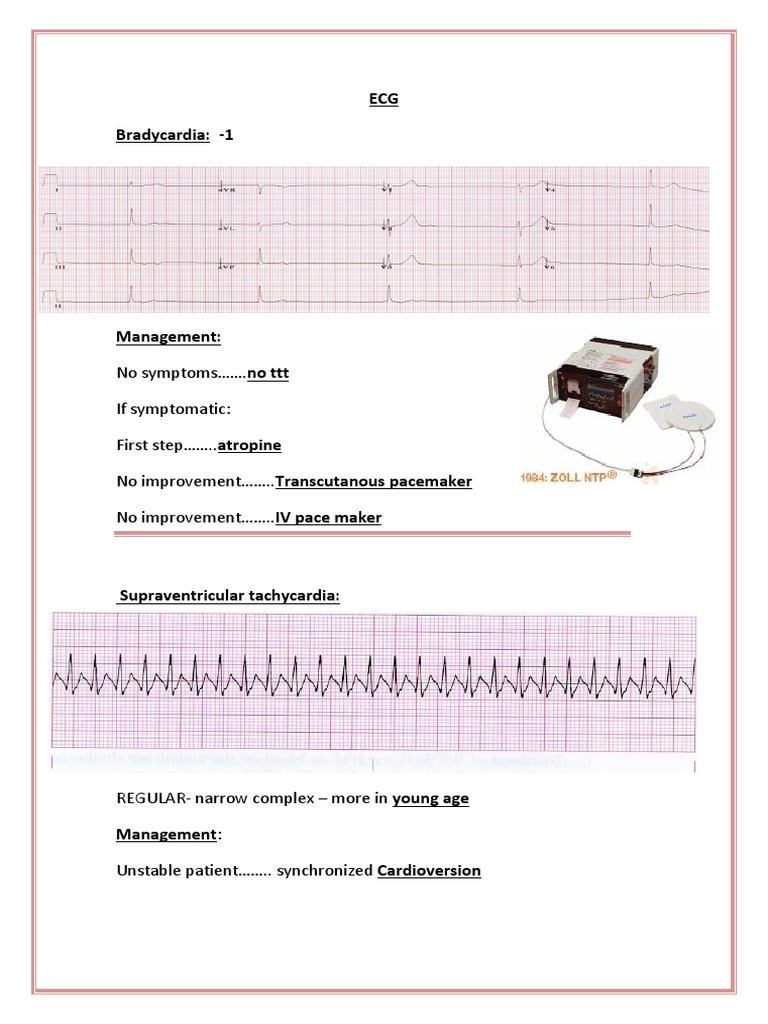 Ecg Pics | PDF | Clinical Medicine | Cardiac Electrophysiology