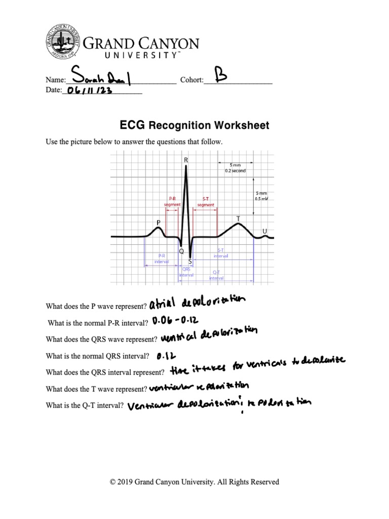 NSG-430 Ecg | PDF | Cardiology | Heart NSG-430 Ecg | PDF | Cardiology | Heart