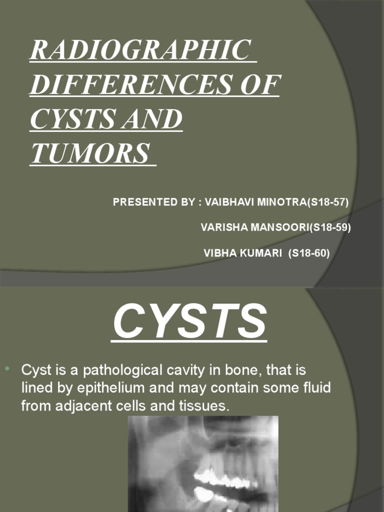 Cysts and Tumors: Radiographic Insights | PDF | Dentistry Branches