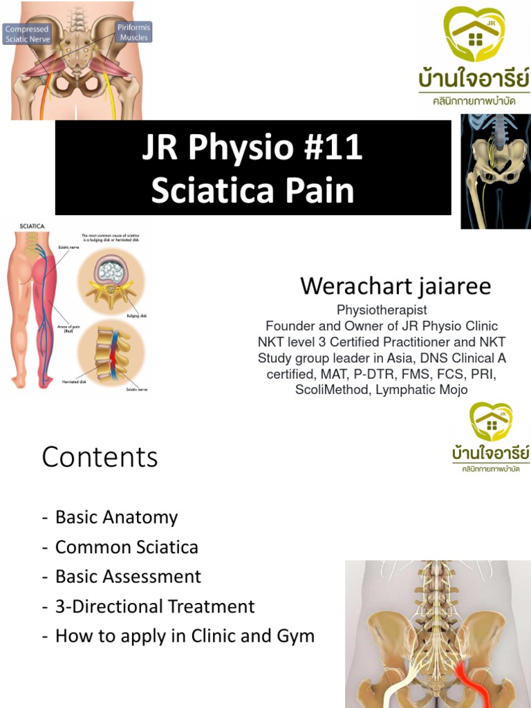 JR Physio11 Sciatica | PDF | Human Leg | Neuroanatomy
