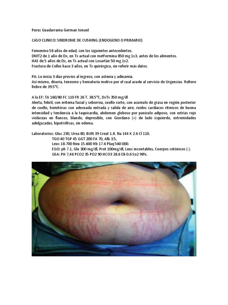 Caso Clinico Sindrome de Cushing Endogeno | PDF | Hormona ...