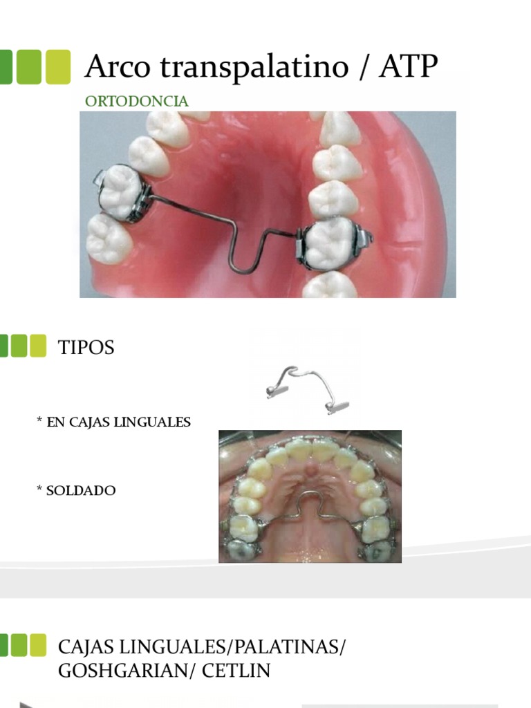 Arco Transpalatino ATP | PDF | Ramas de Odontología