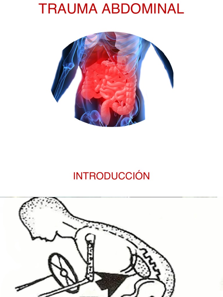 Trauma Abdominal | PDF | Lesión | Abdomen