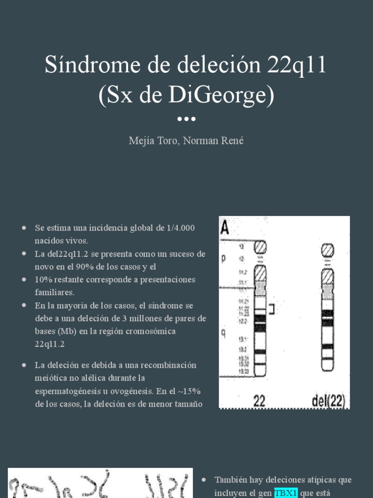 Síndrome de Deleción 22q11 (SX de DiGeorge) | PDF