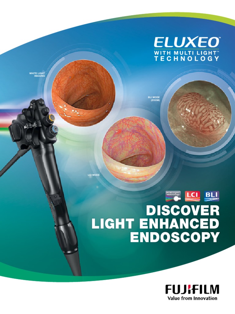 Eluxeo Multi Light Technology | PDF | Colonoscopy | Telescopic Sight
