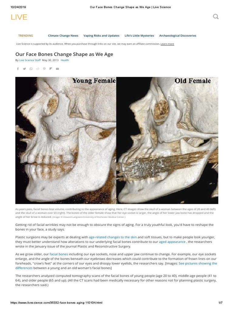 Our Face Bones Change Shape As We Age - Live Science | PDF | Plastic ...