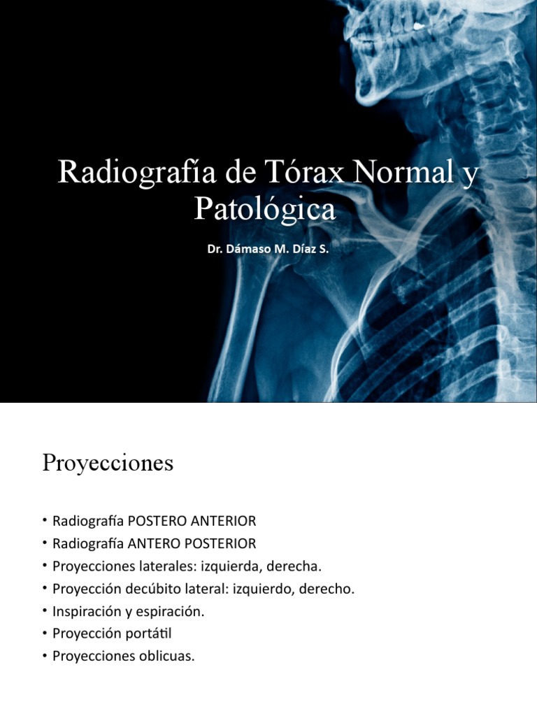 Rx. CT, USG, PFP | PDF | Enfermedad pulmonar obstructiva crónica | Pulmón