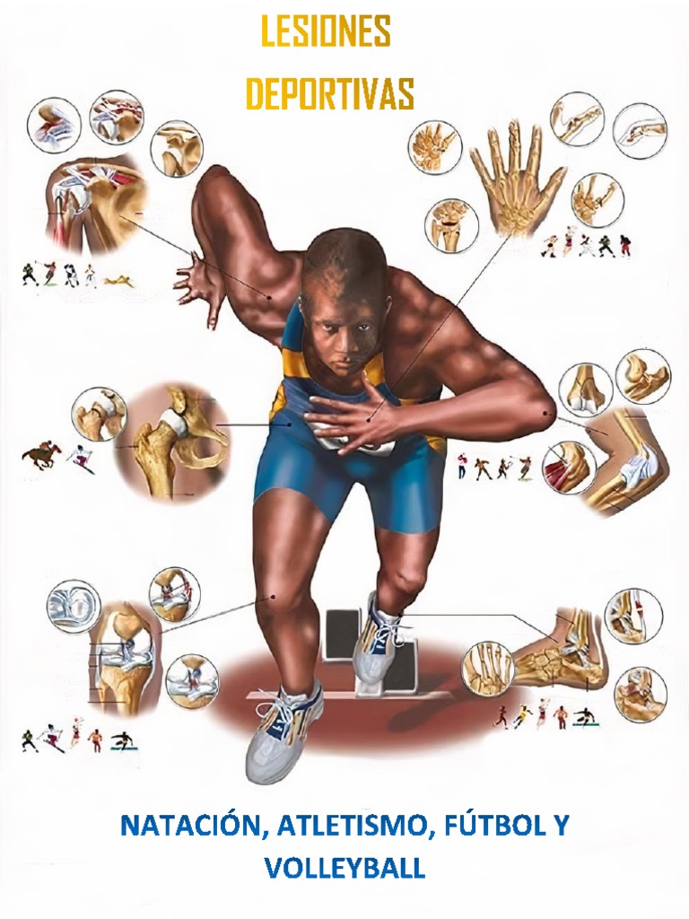 Lesiones Deportivas | PDF