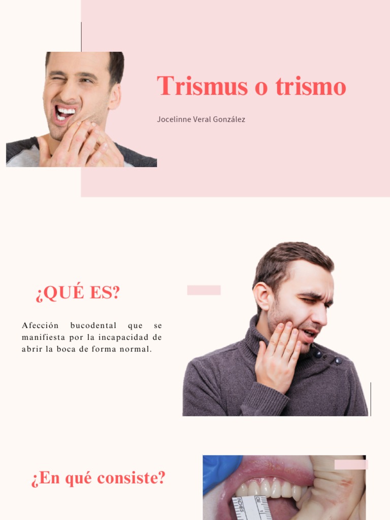 Sintomas De Trismo O Que é Trismo E Qual Seu Tratamento? Clínica