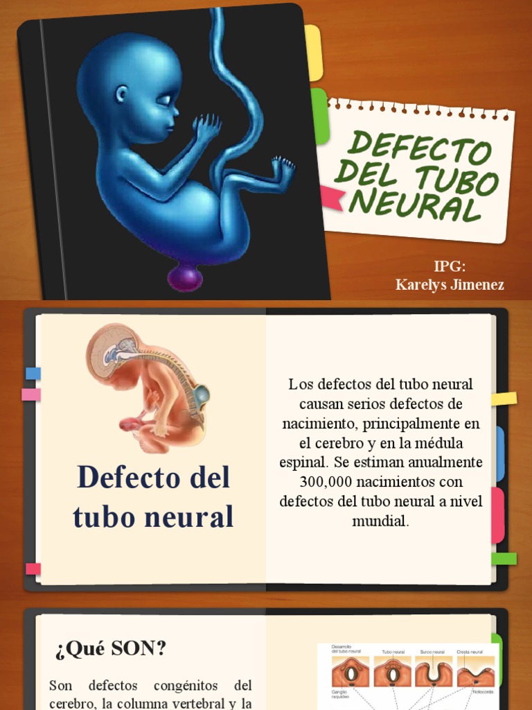 Defecto Del Tubo Neuronal | PDF | El embarazo | Médula espinal