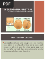 Tipos de incisiones abdominales | PDF | Abdomen | Cirugía