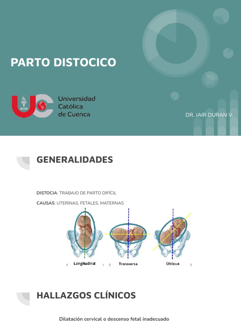 CLASE 5 - PARTO DISTOCICO | PDF | Parto | Embarazo humano