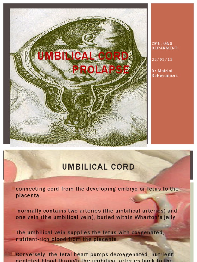 Umbilical Cord Prolapse | PDF | Childbirth | Fetus