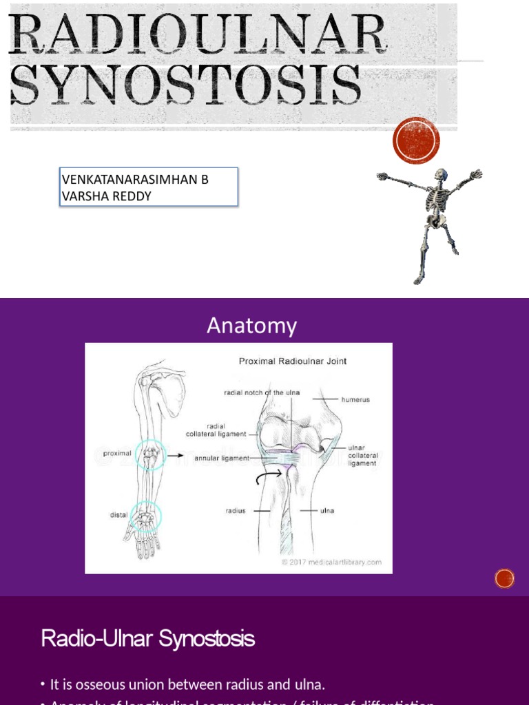 Congenital Radio-Ulnar Synostosis Overview | PDF | Elbow | Anatomical ...