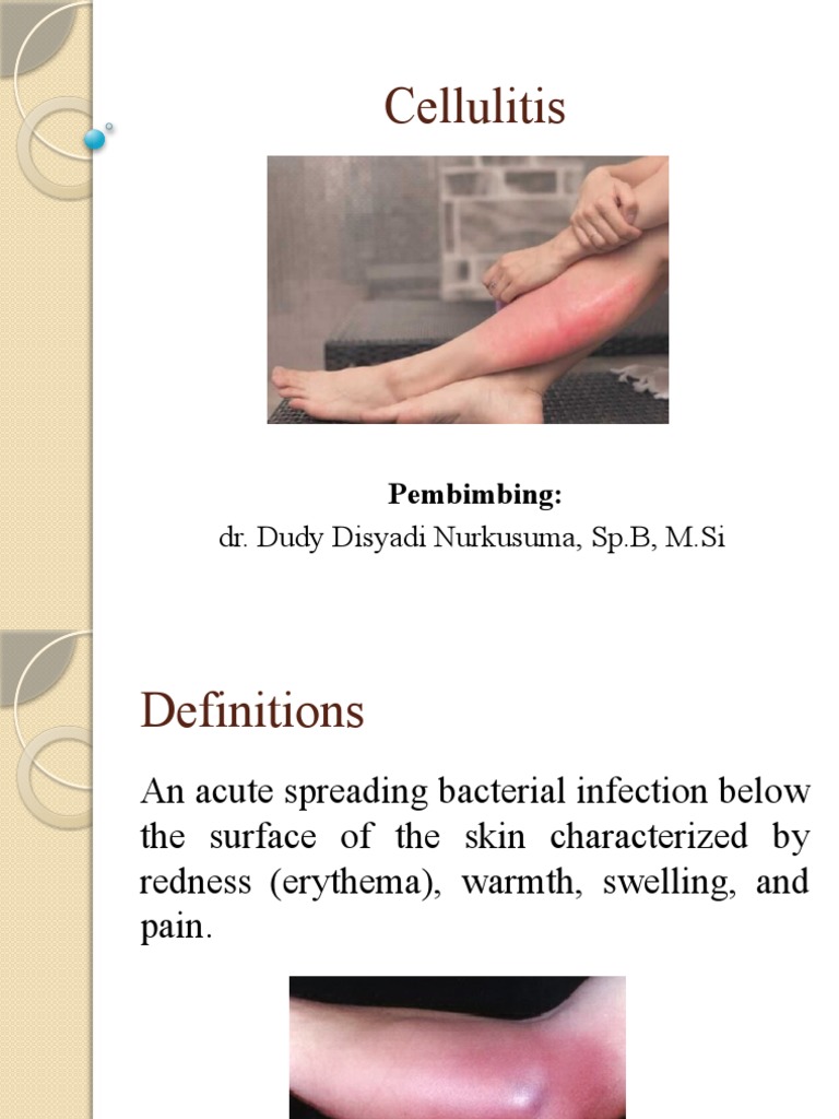 SELULITIS | Download Free PDF | Causes Of Death | Diseases And Disorders