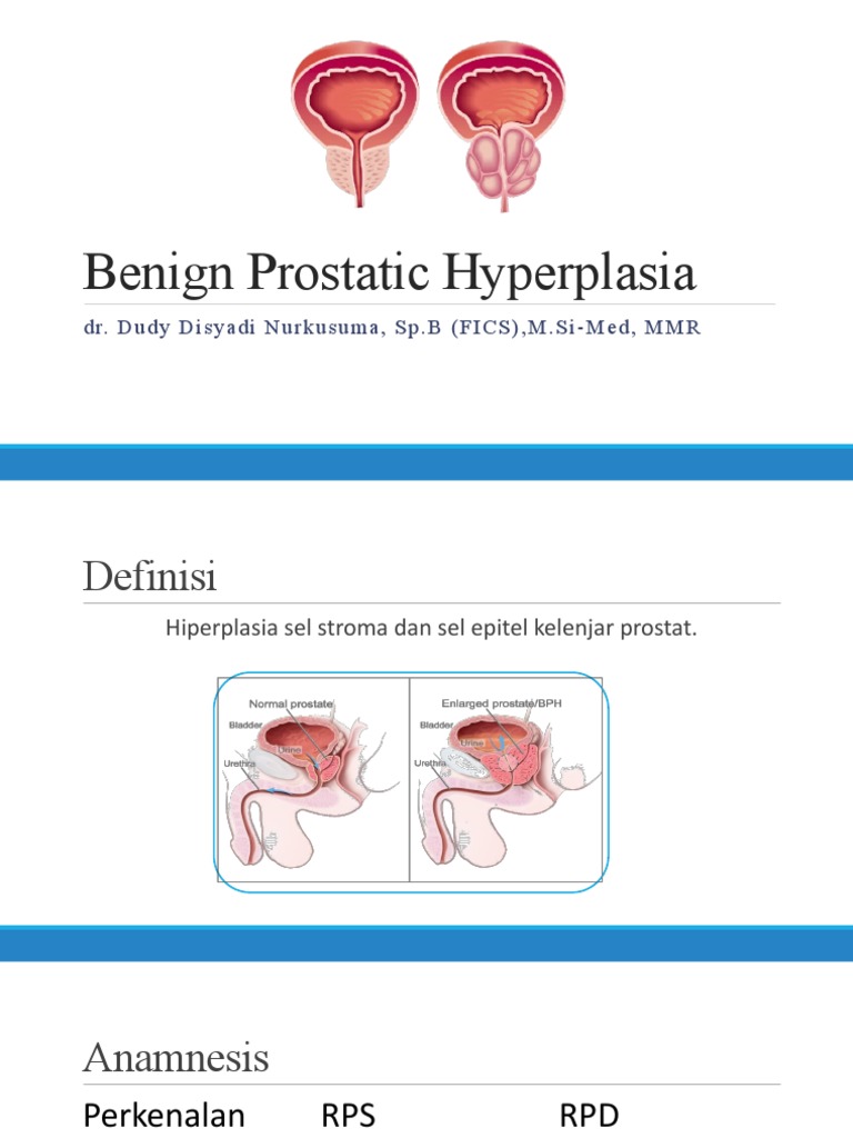 Benign Prostatic Hyperplasia | PDF