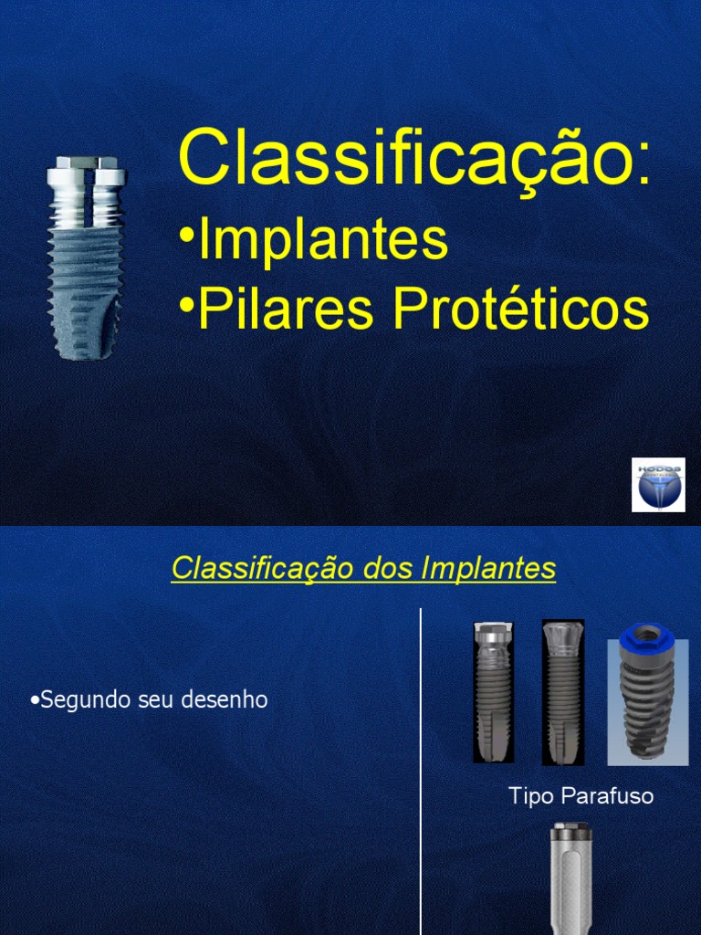 Classificao e Tipos de Implantes e Componentes Proteticos | PDF