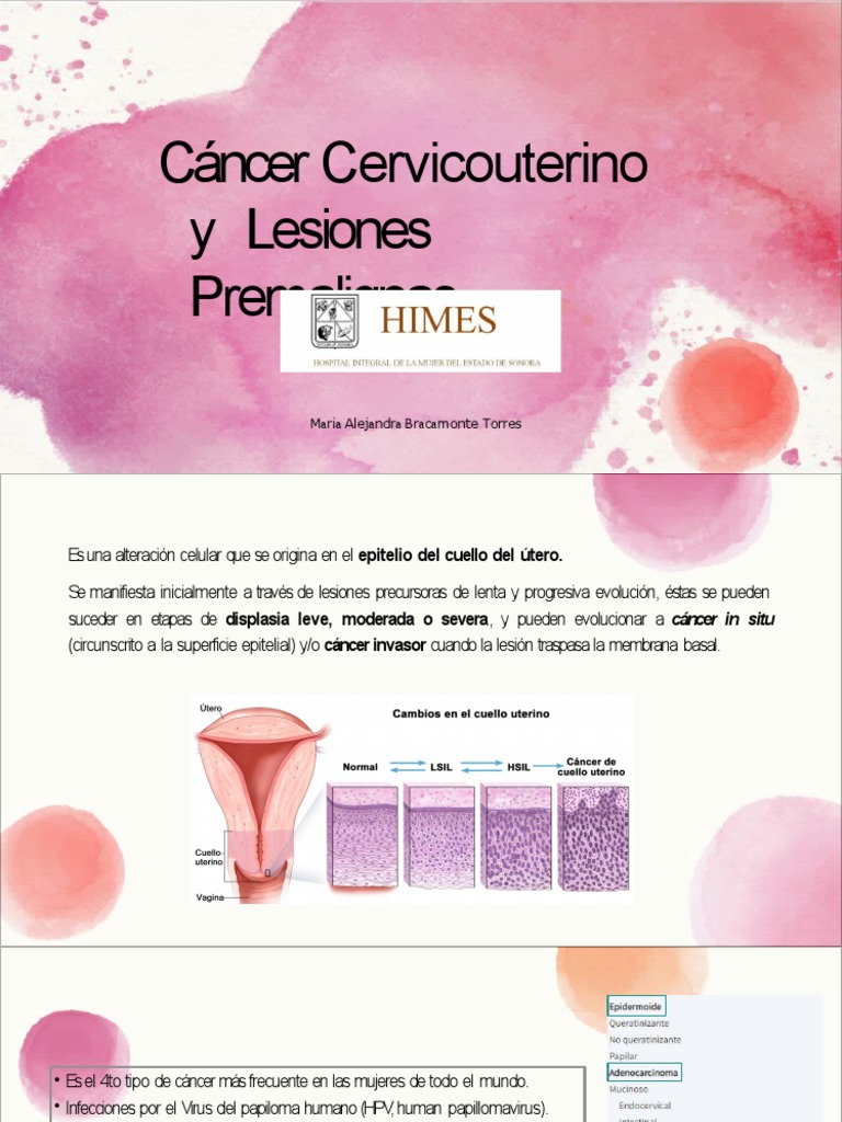 Cancer Cervicouterino y Lesiones Premalignas | PDF | Cáncer de cuello ...