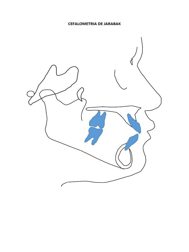 Cefalometria de Jarabak | PDF
