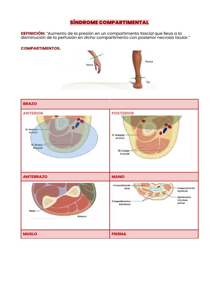 Síndrome Compartimental Gpc – Síndrome Compartimental: Causas, Síntomas ...