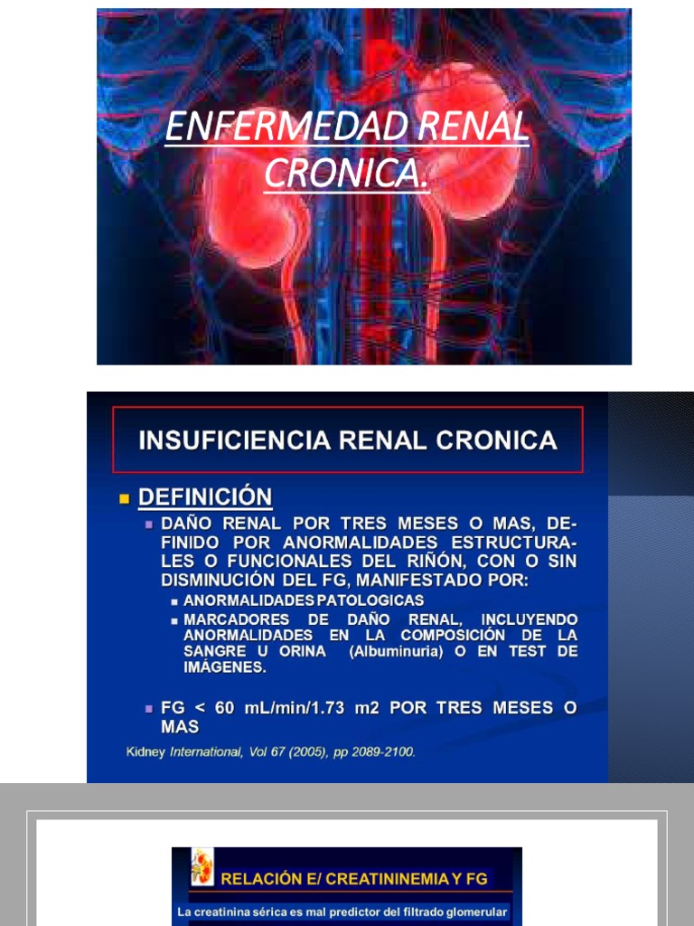 Enfermedad Renal Crónica | PDF | Enfermedad renal crónica | Sistema endocrino