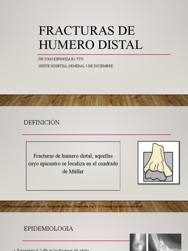 Fracturas de Humero Distal | PDF | Codo | Sistema musculoesquelético