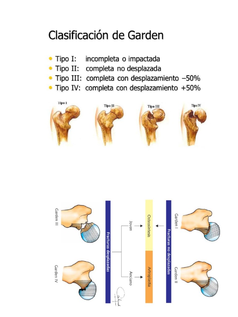 Clasificacion de Garden | PDF