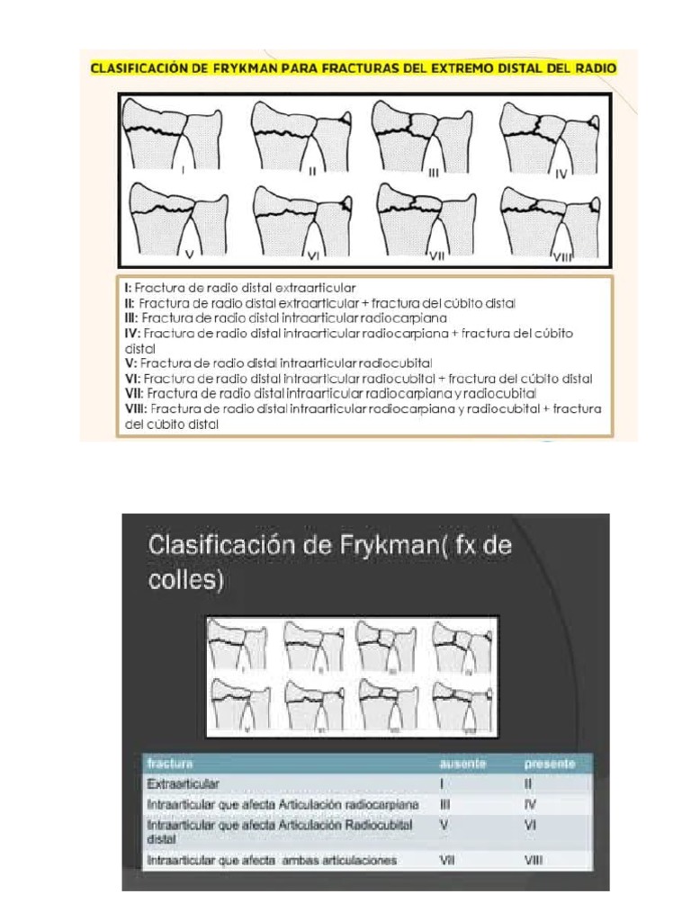 Clasificacion Frykman | PDF