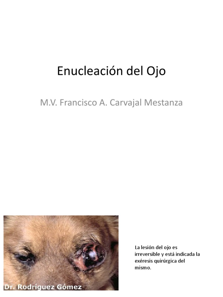 Enucleacion de Ojo | PDF