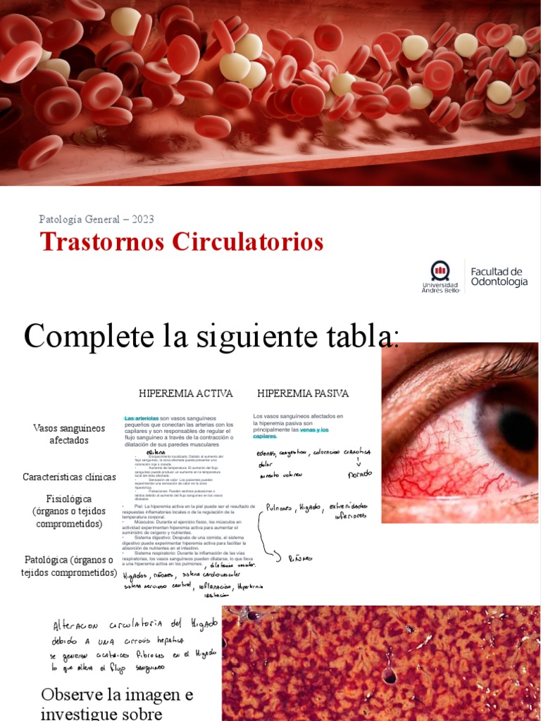 Paso Trastornos Circulatorio | PDF | Embolia | Trombo