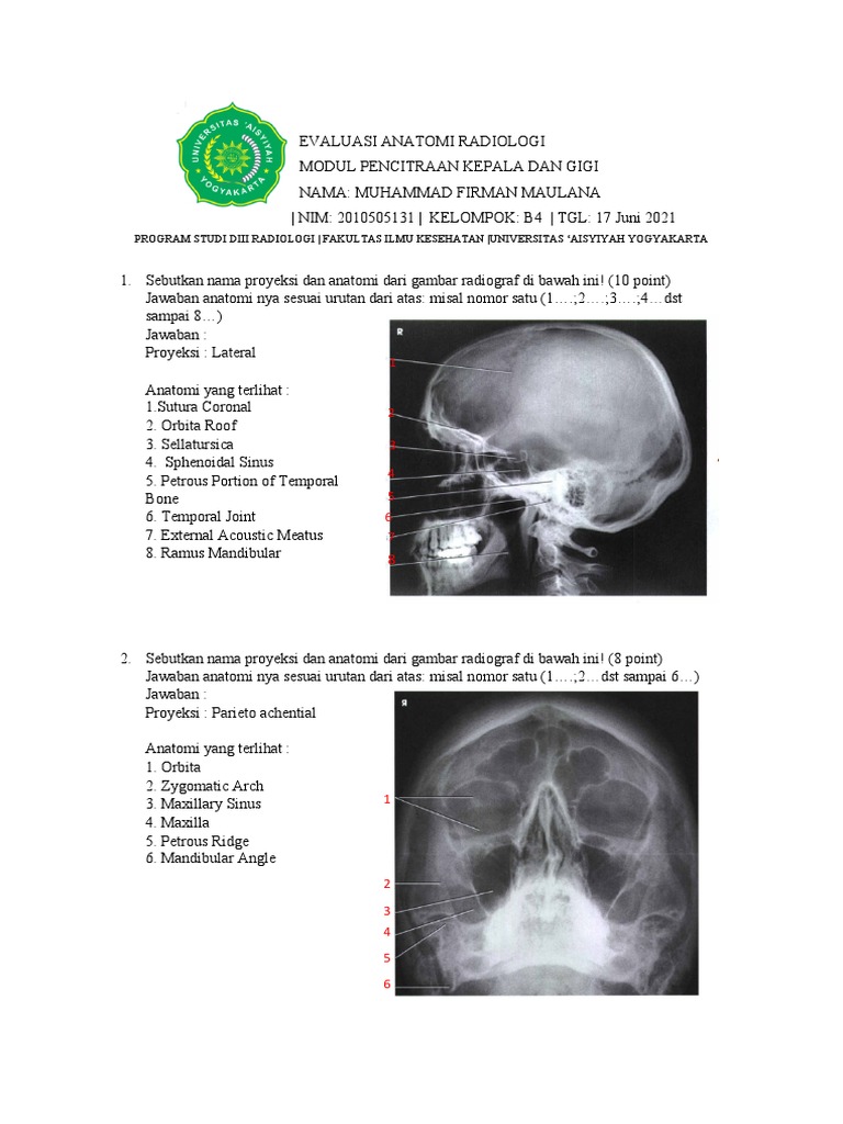 SOAL P21.Evaluasi Anrad Kepala Dan Gigi | PDF