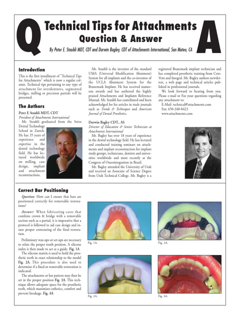 Milled Anterior Bridge Swissloc | PDF | Dental Implant | Dentistry