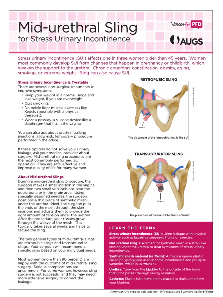 Mid-Urethral Sling | PDF