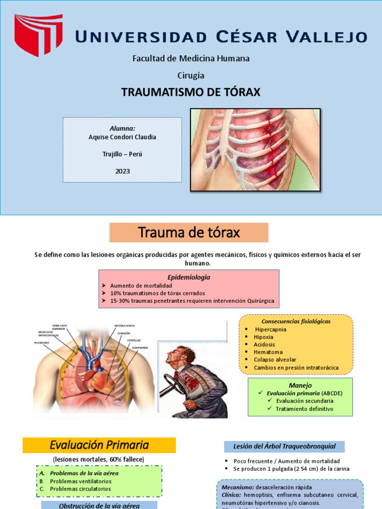 Traumatismo de Torax - Claudia Aquise | Descargar gratis PDF | Causas de la muerte | Medicina ...
