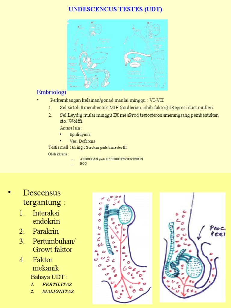 Undesensus Testis | PDF