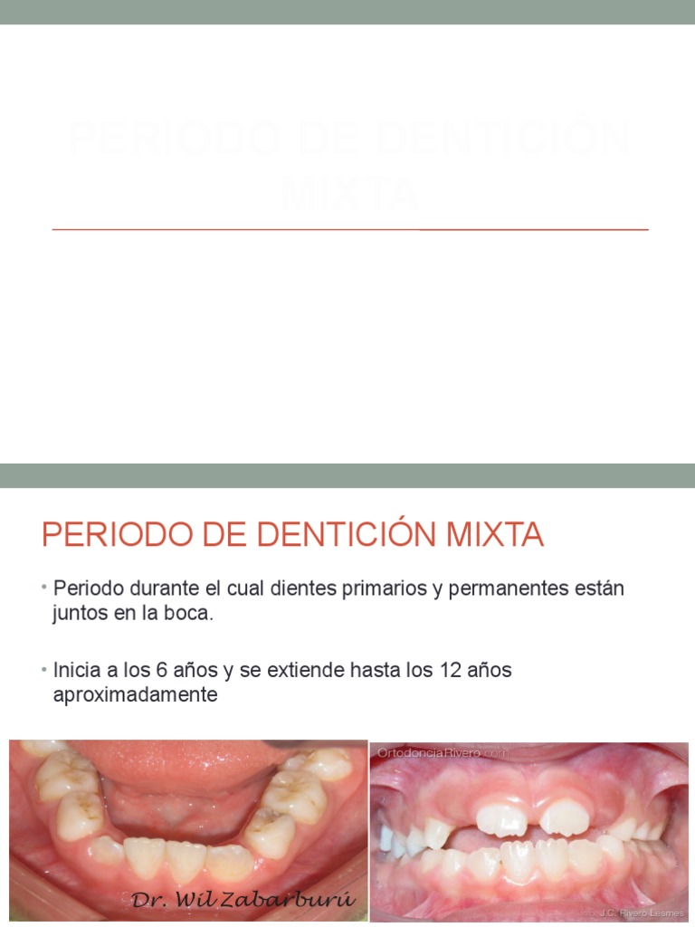 Periodo de Dentición Mixta | PDF | Diente | Odontología