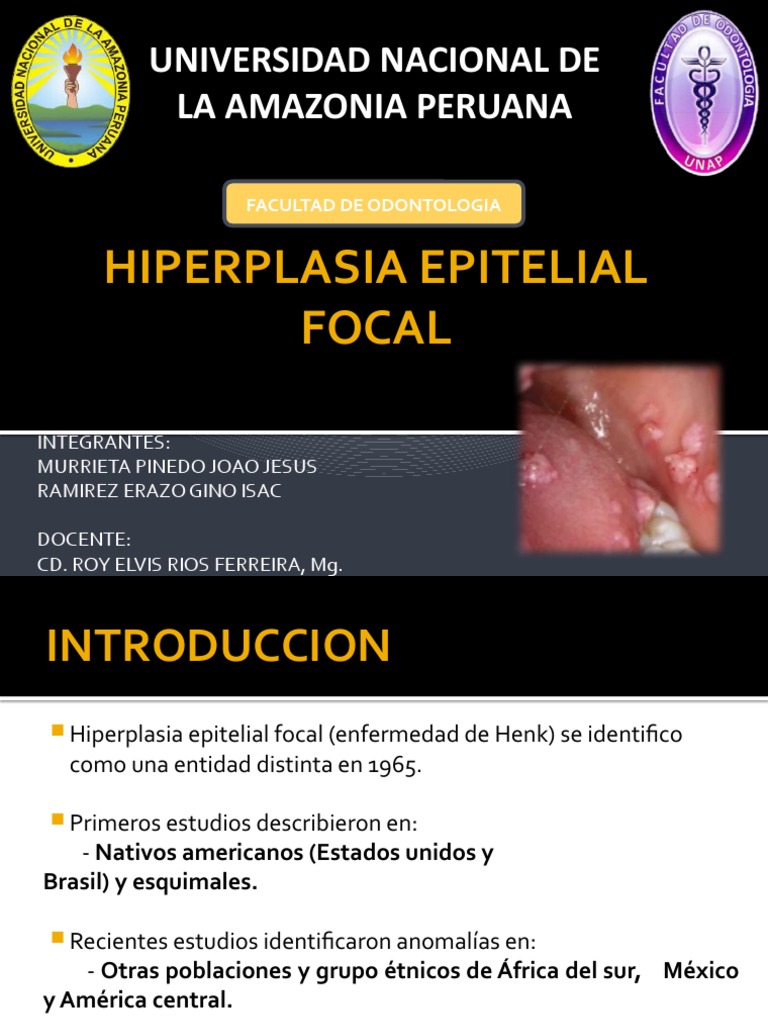 Hiperplasia Epitelial Focal: Etiología y Diagnóstico | PDF | Medicina ...