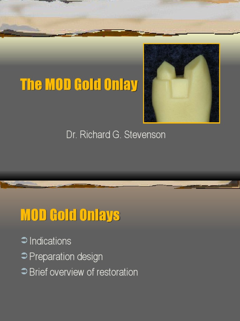 MOD Gold Onlay Preparation Guide | PDF