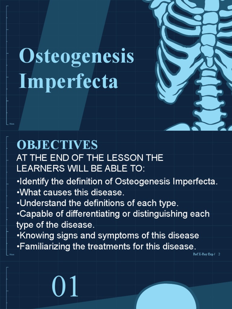 Beaded Ribs in Osteogenesis Imperfecta | PDF | Musculoskeletal System ...