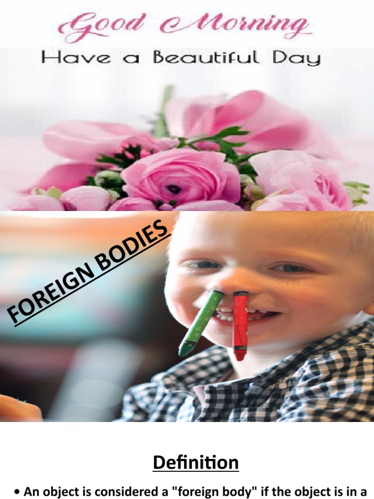 Understanding Foreign Bodies in Children | PDF | Wellness