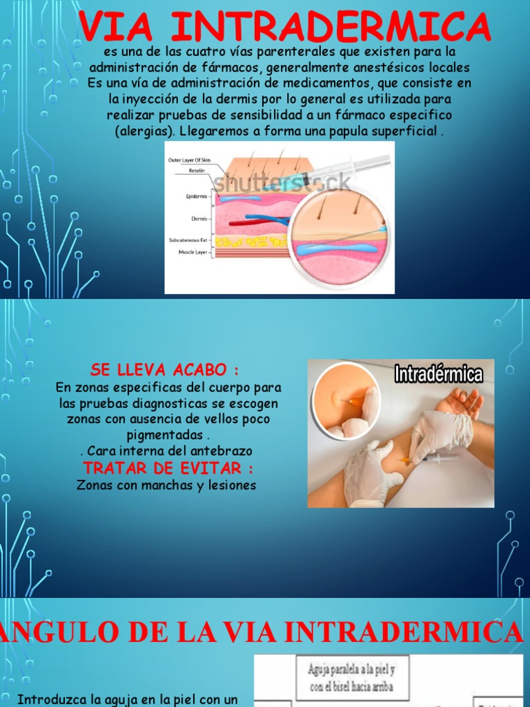Via Intradermica | PDF | Inyección (medicina) | Terapia intravenosa
