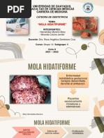 Mola | PDF | El embarazo | Control de la natalidad