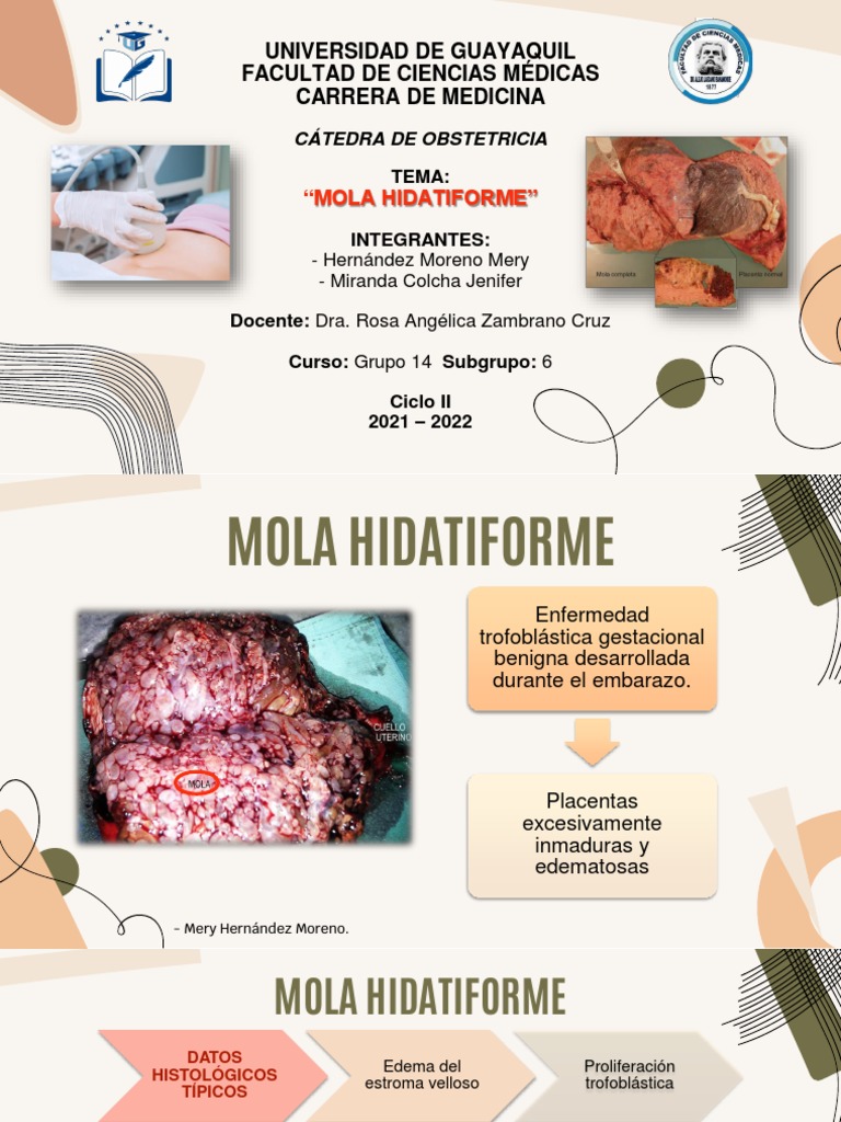 Mola Hidatiforme - Obstetricia Final | PDF | El embarazo | Embarazo ...