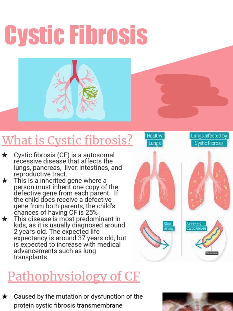 Cystic Fibrosis Presentation | PDF | Diseases And Disorders | Epidemiology