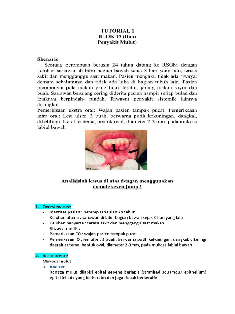 Rangkuman Tutorial Stomatitis Aftosa Rekuren | PDF