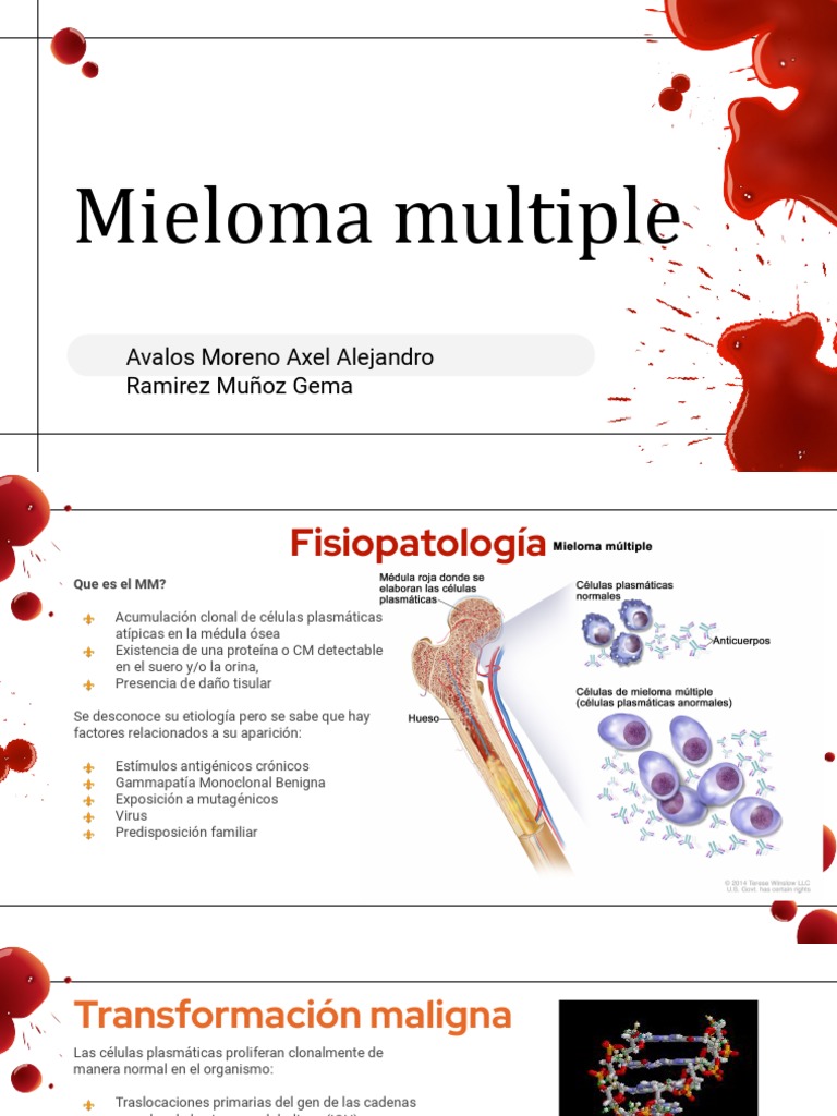 Mieloma Multiple | PDF | Mieloma múltiple | Sangre