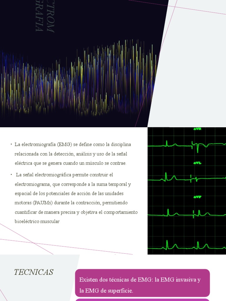 ELECTROMIOGRAFIA | PDF | Electromiografia | Unión neuromuscular